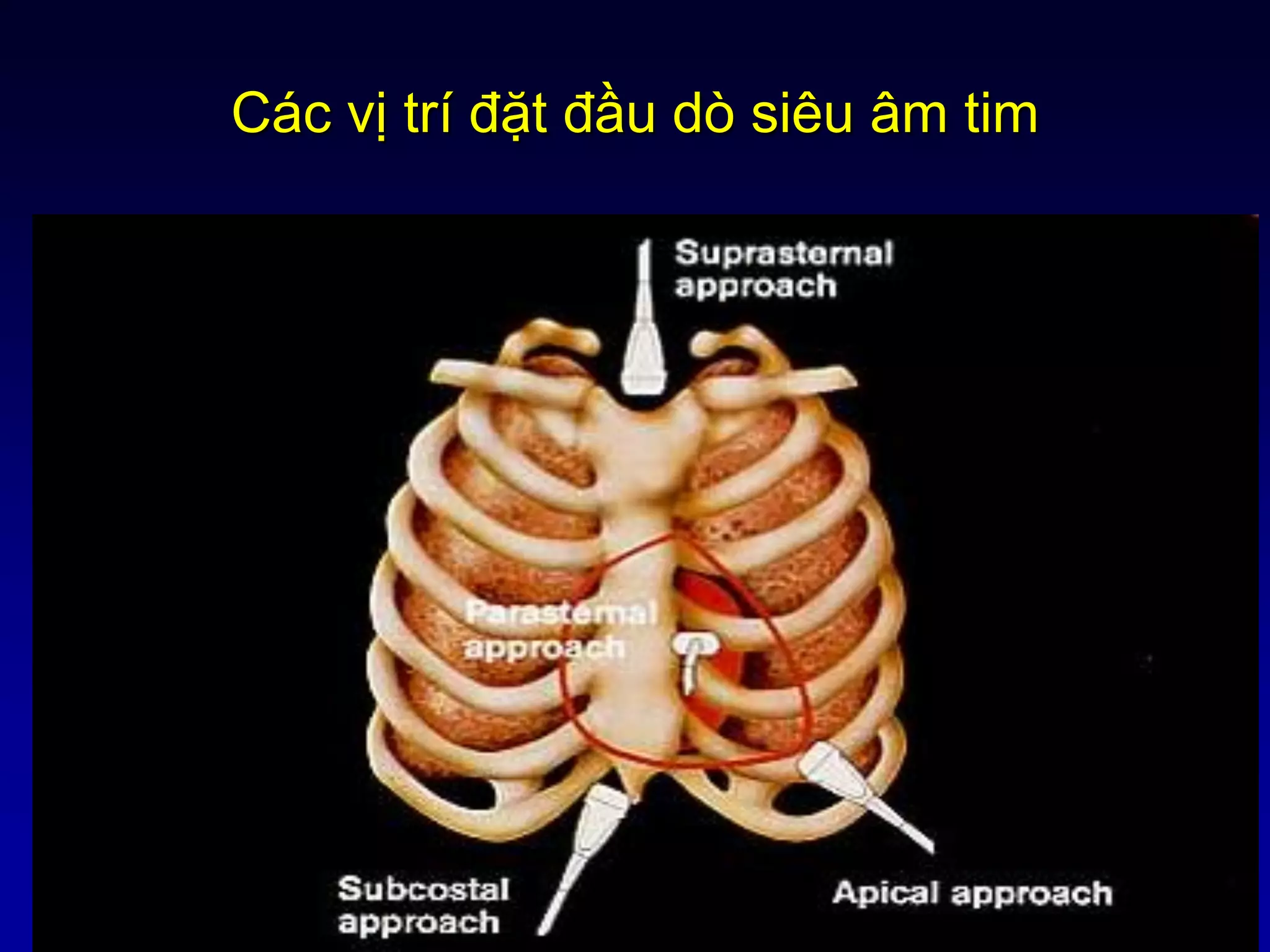 05. sieu am tim co ban | PDF