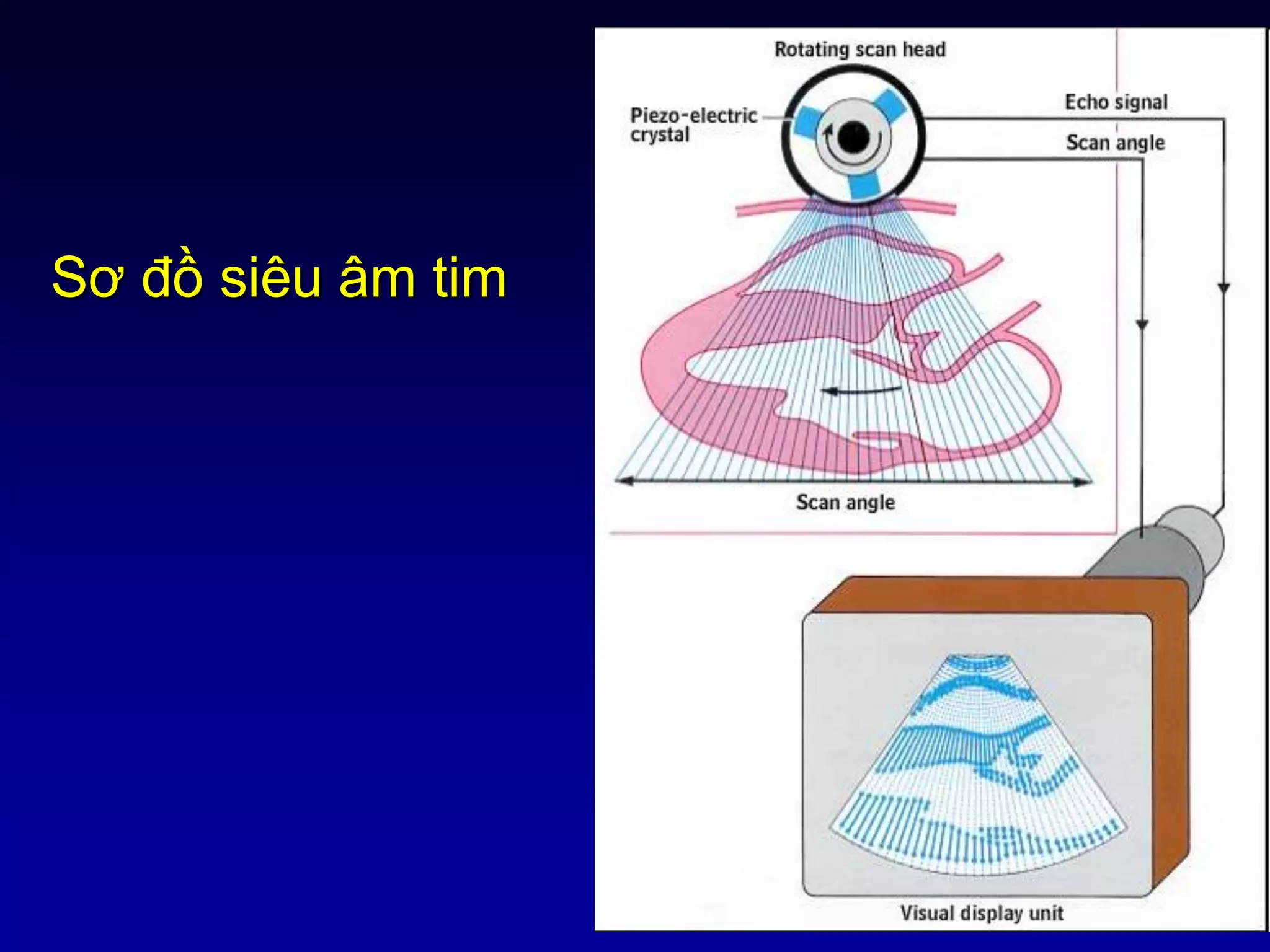 05. sieu am tim co ban | PDF