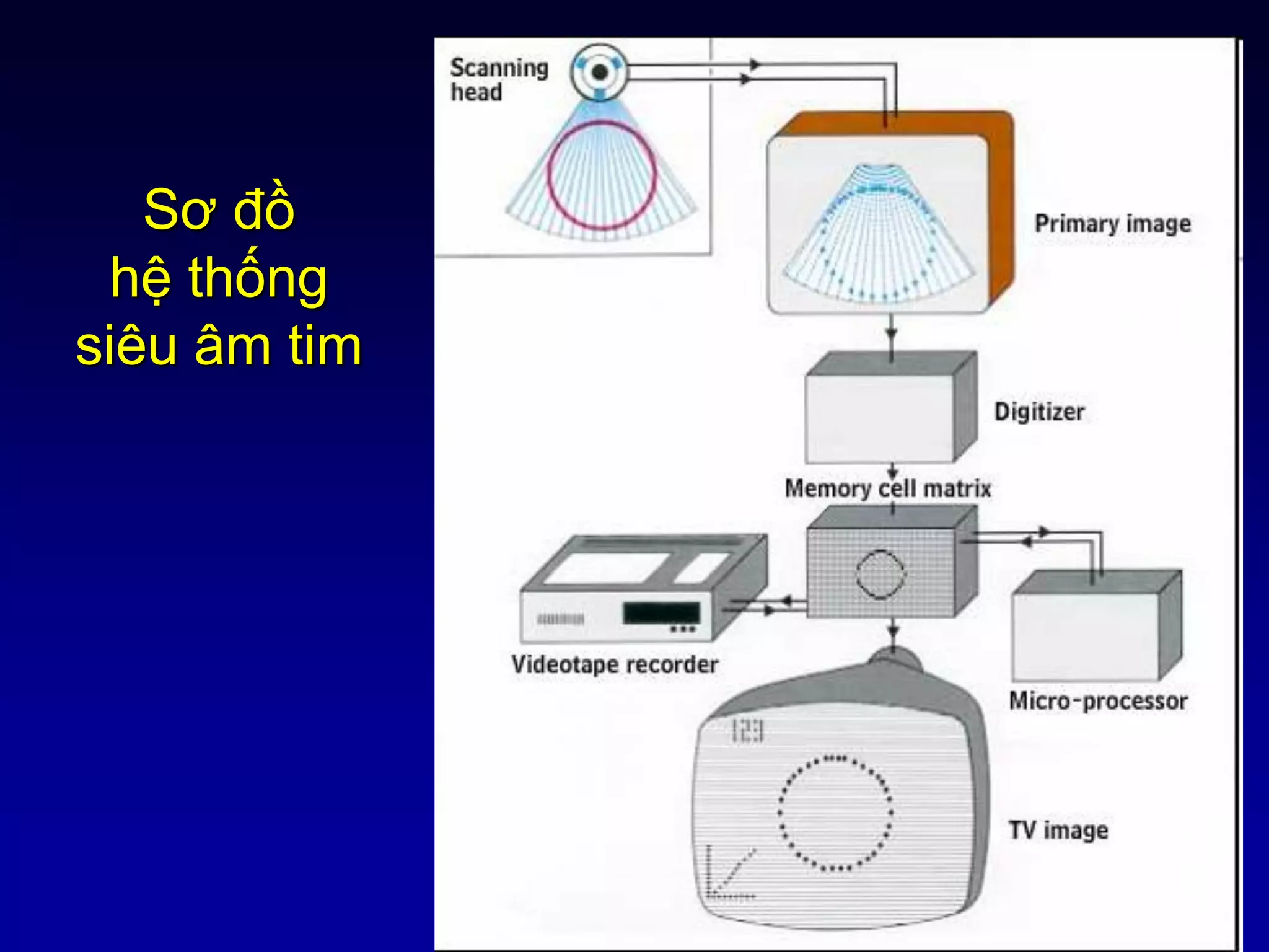 05. sieu am tim co ban | PDF