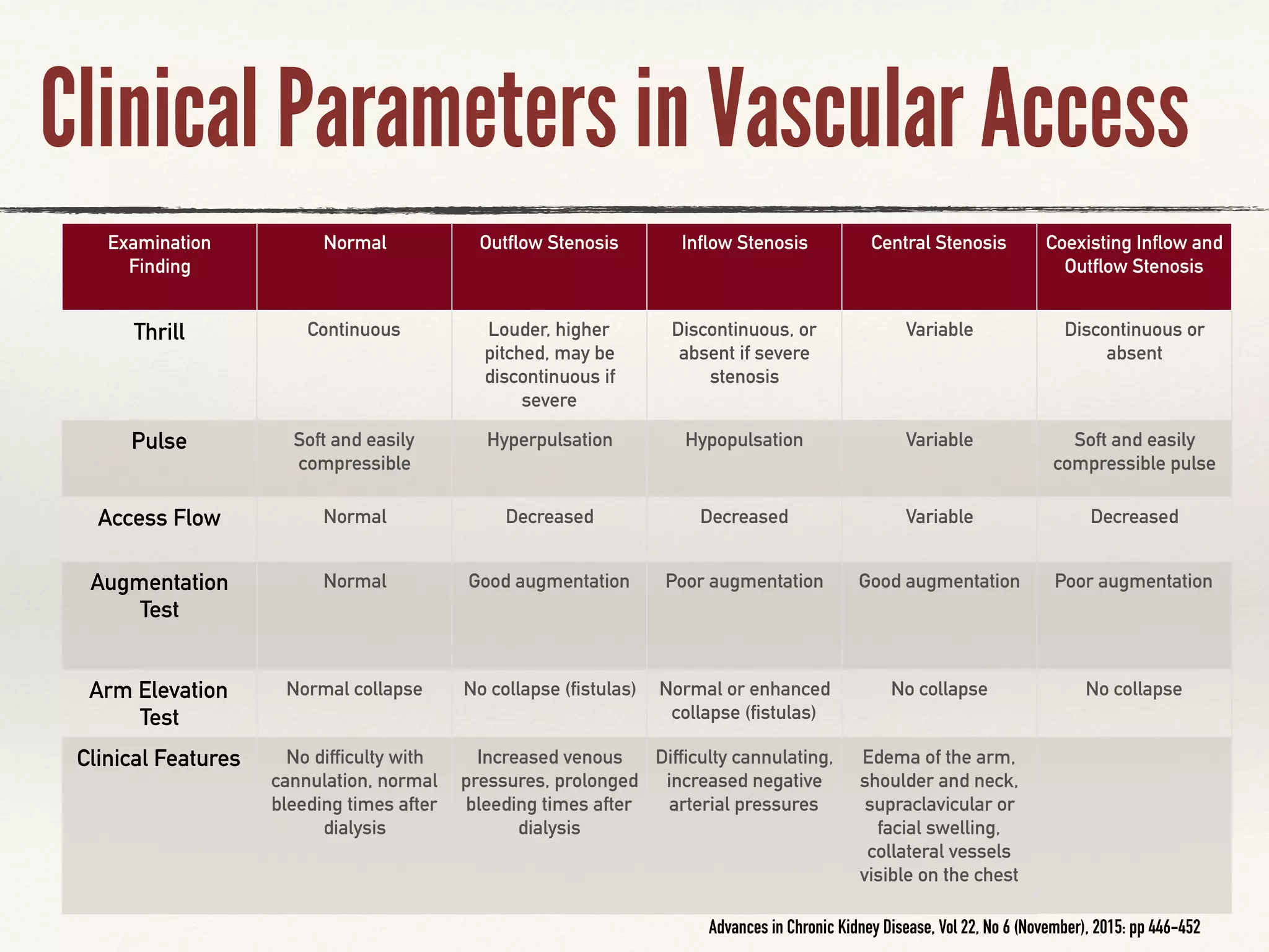 Vascular access in hemodialysis chaken 2018 | PDF