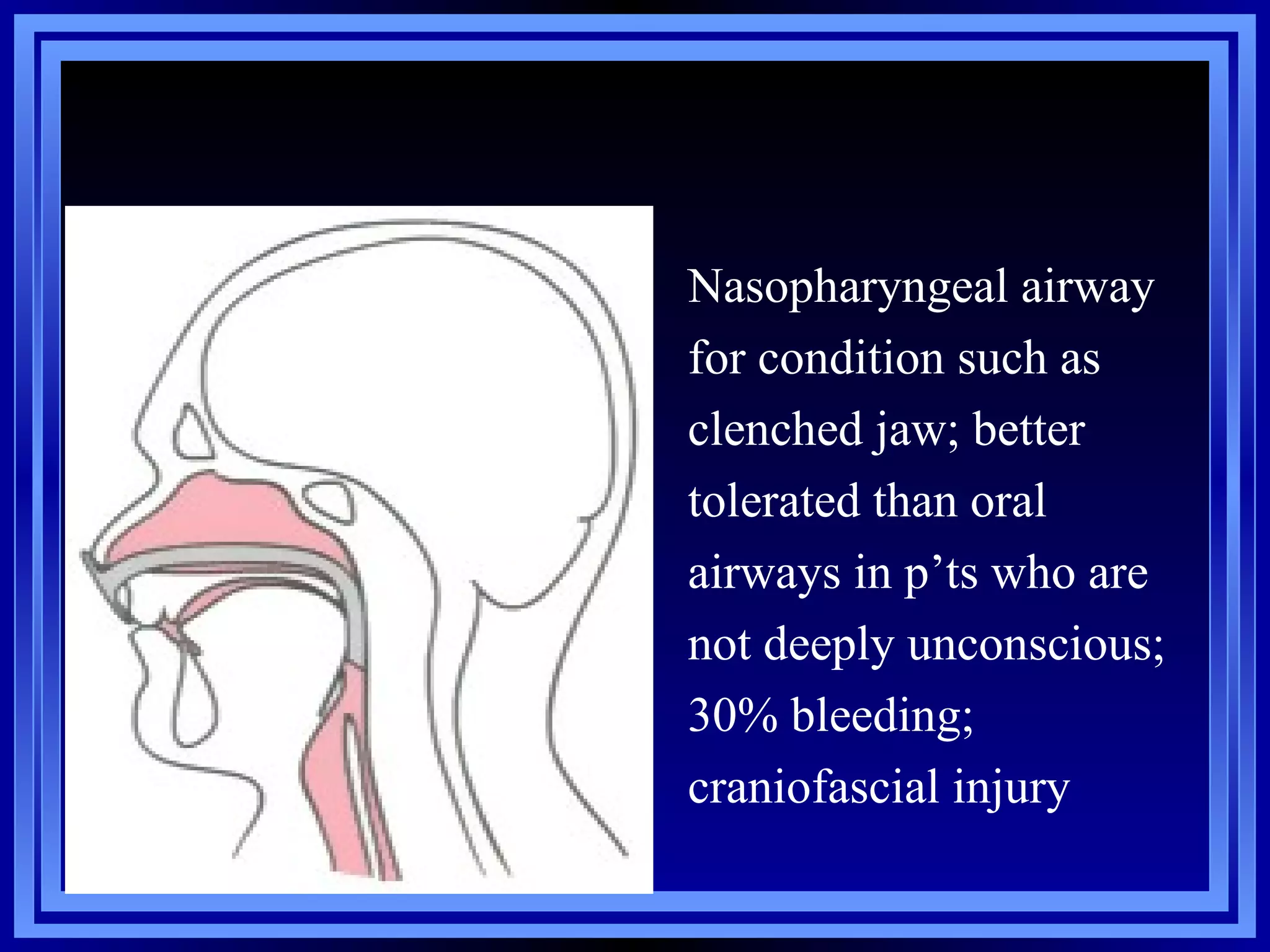 management of airway | PPT | Death, Injury, or Military Conflict ...
