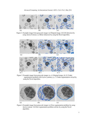 A NOVEL IMAGE SEGMENTATION ENHANCEMENT TECHNIQUE BASED ON ACTIVE ...