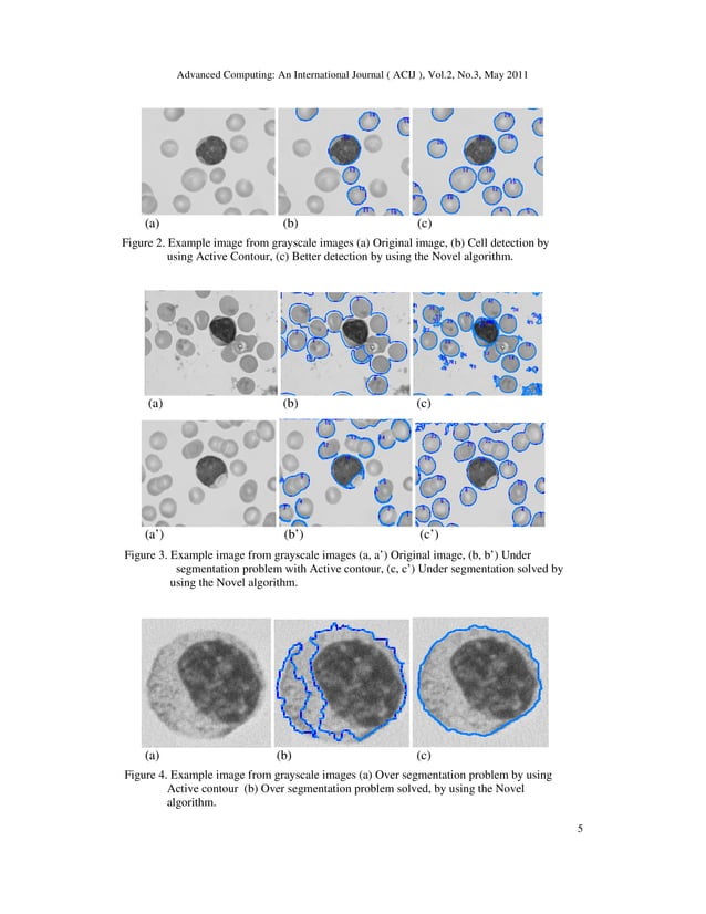 A NOVEL IMAGE SEGMENTATION ENHANCEMENT TECHNIQUE BASED ON ACTIVE CONTOUR AND TOPOLOGICAL ...