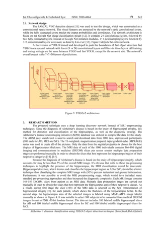 Alzheimer’s diseases classification using YOLOv2 object detection ...