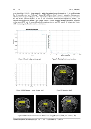 Alzheimer’s diseases classification using YOLOv2 object detection ...