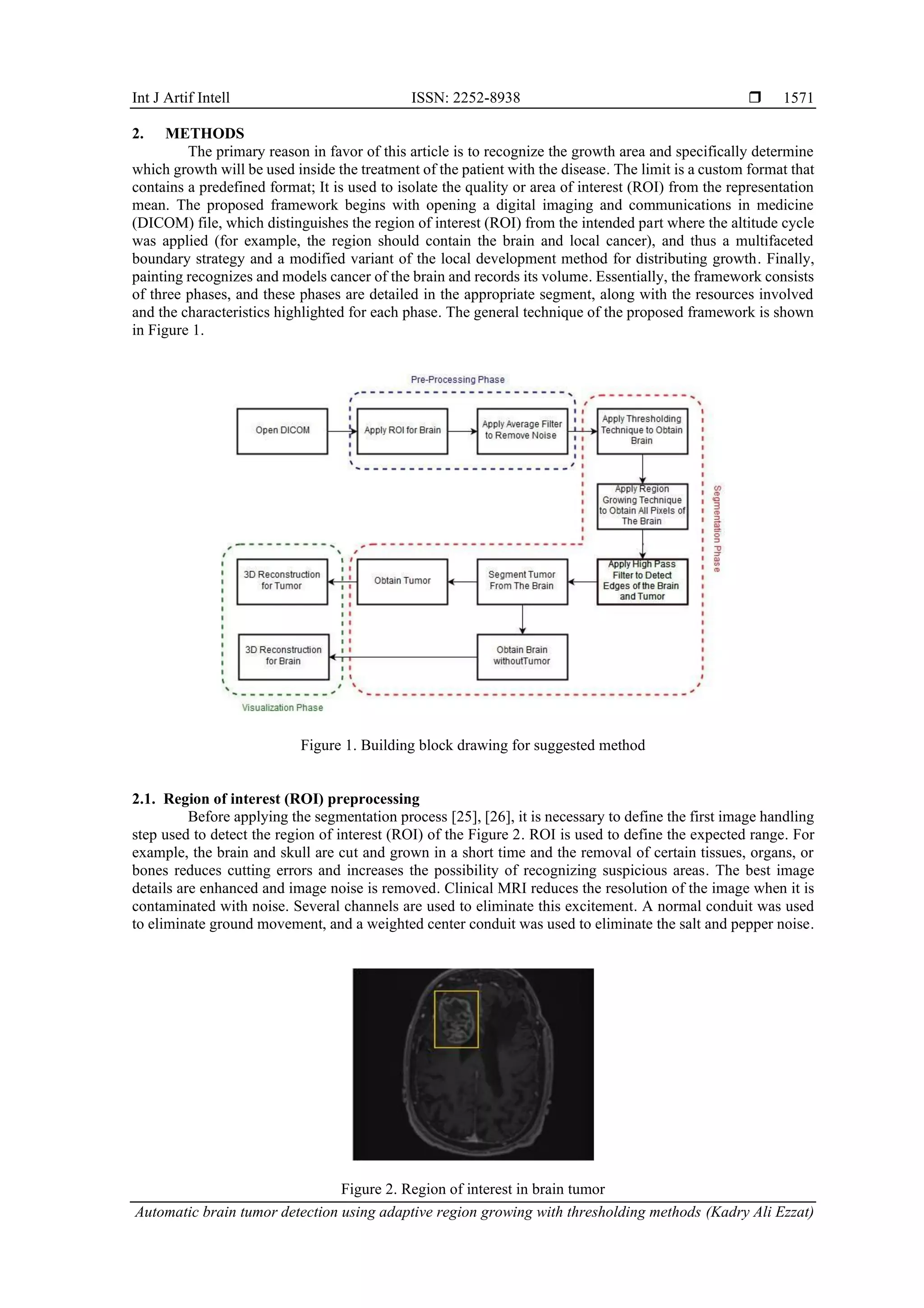 Automatic Brain Tumor Detection Using Adaptive Region Growing With