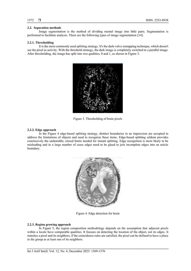 Automatic Brain Tumor Detection Using Adaptive Region Growing With