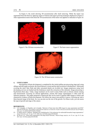 Automatic brain tumor detection using adaptive region growing with thresholding methods | PDF