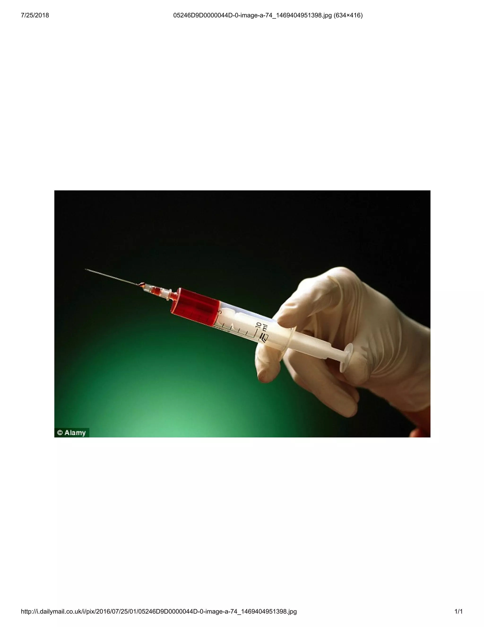 Stem cell injection | PDF