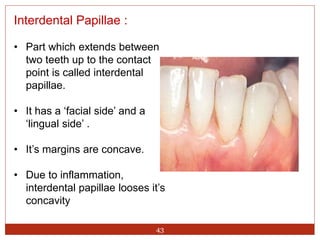Oral mucous membrane - Oral mucosa | PPTX