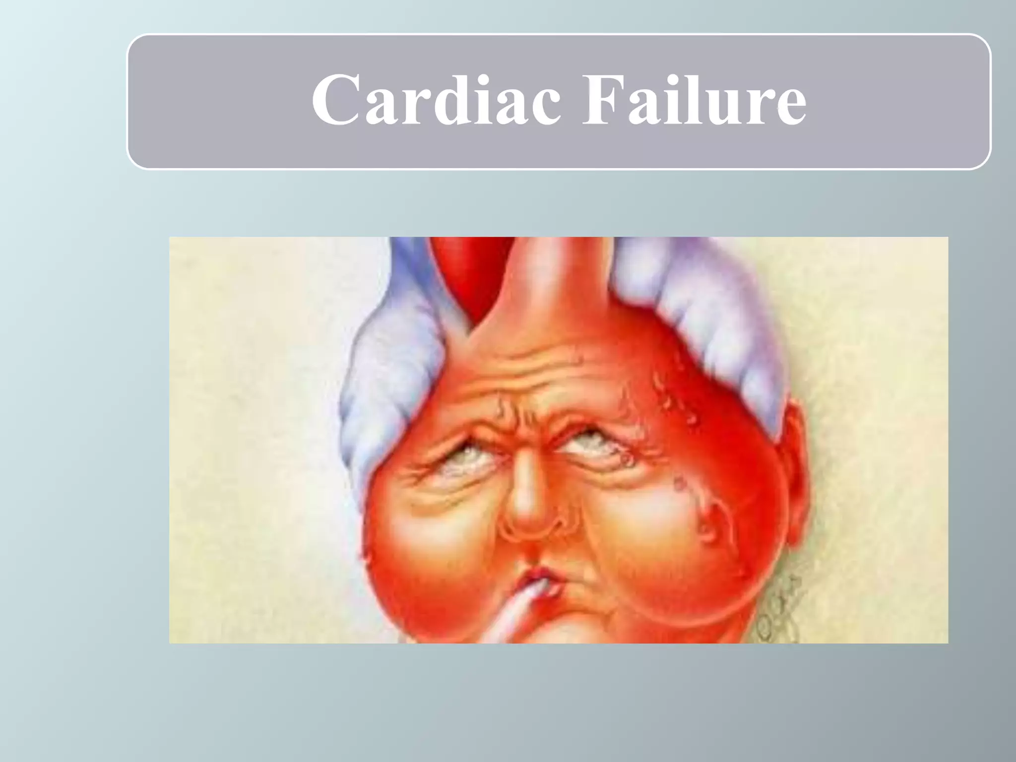 Heart Failure | PPT