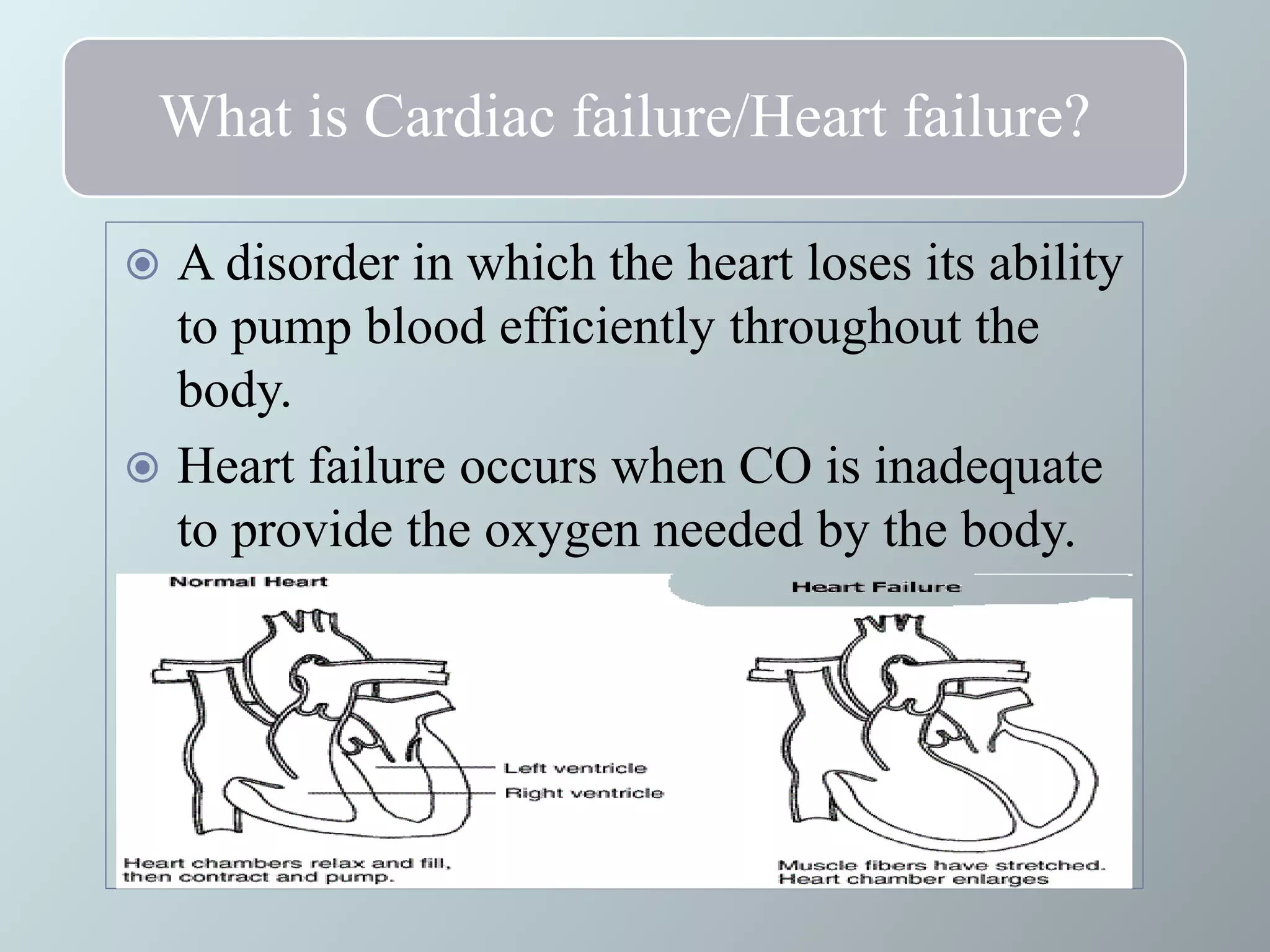 Heart Failure | PPT