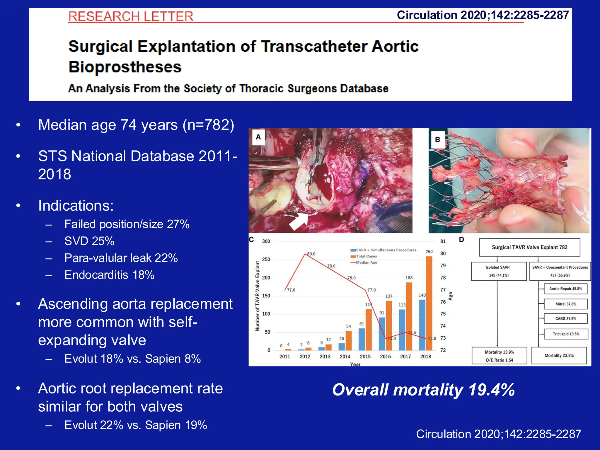 Transcatheter Aortic Valve (TAVR) Explant | PDF