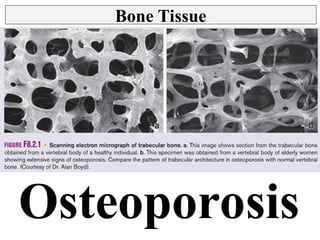 Bone Tissue - Histology Slides - Identification & Types | PPT