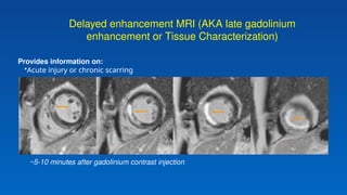 Vasodilator Cardiac MRI Stress Testing (Cardiac Imaging) | PPTX