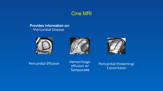 Vasodilator Cardiac MRI Stress Testing (Cardiac Imaging) | PPTX