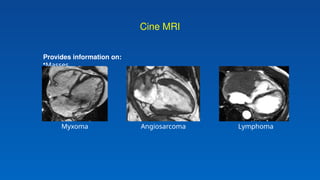 Vasodilator Cardiac MRI Stress Testing (Cardiac Imaging) | PPTX