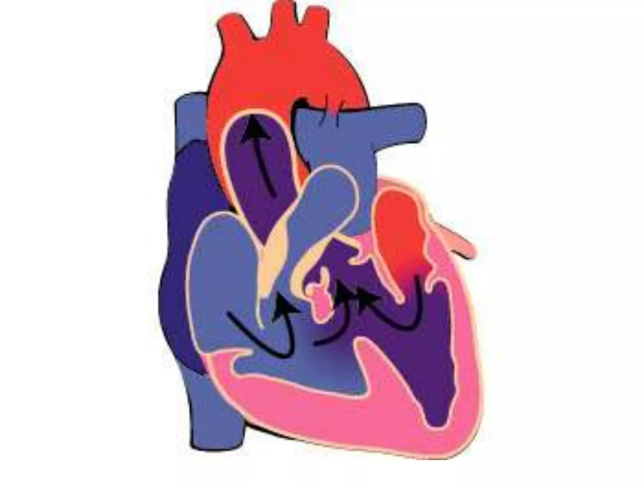 05 cardiac pathology | PPT