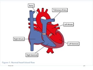 05 cardiac pathology | PPT
