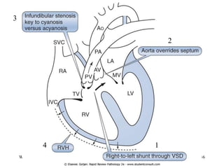 05 cardiac pathology | PPT