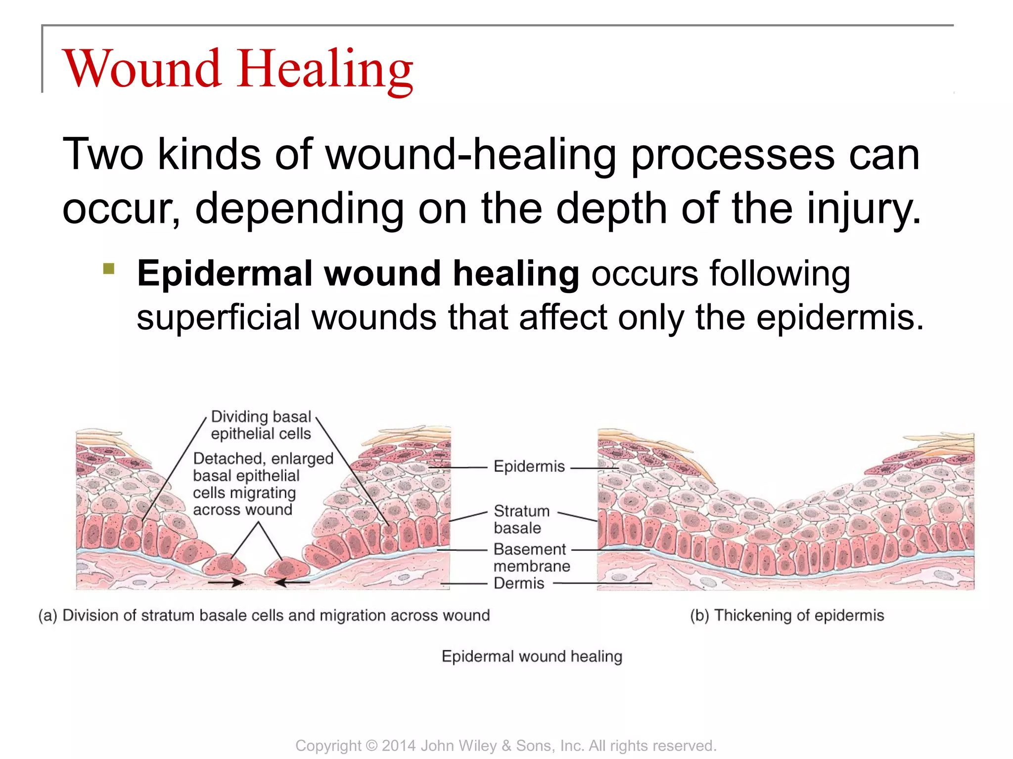 05 [chapter 5 the integumentary system] | PPT