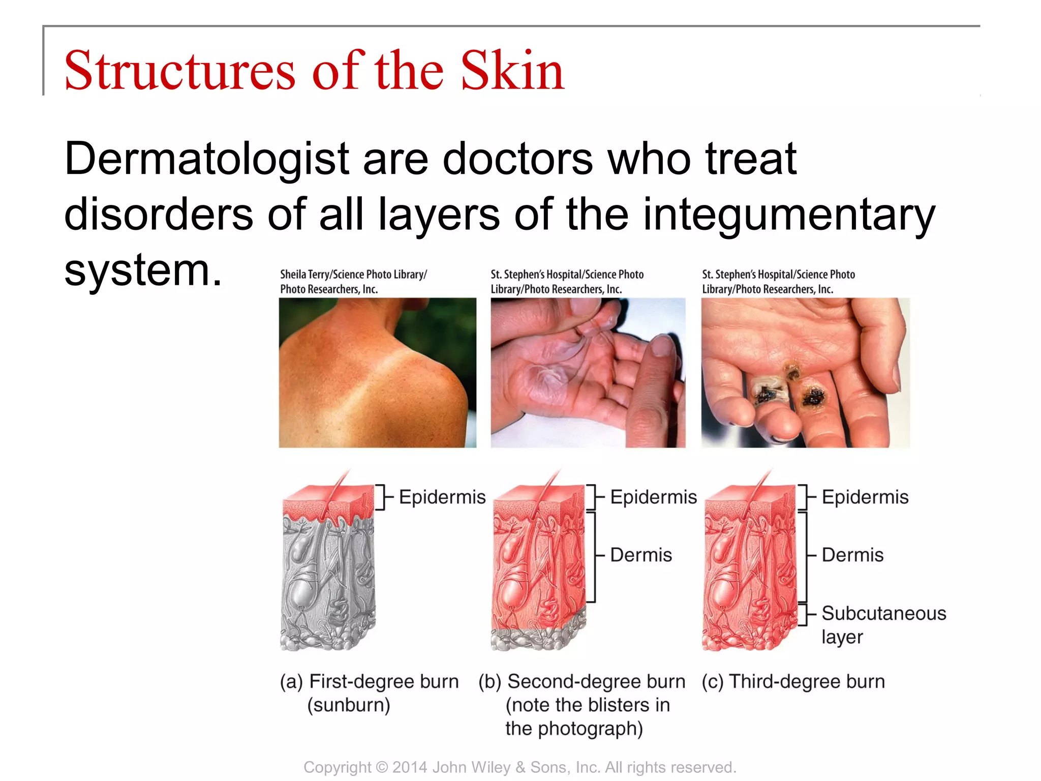 05 [chapter 5 the integumentary system] | PPT