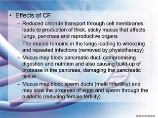 05 Cystic Fibrosis | PPT