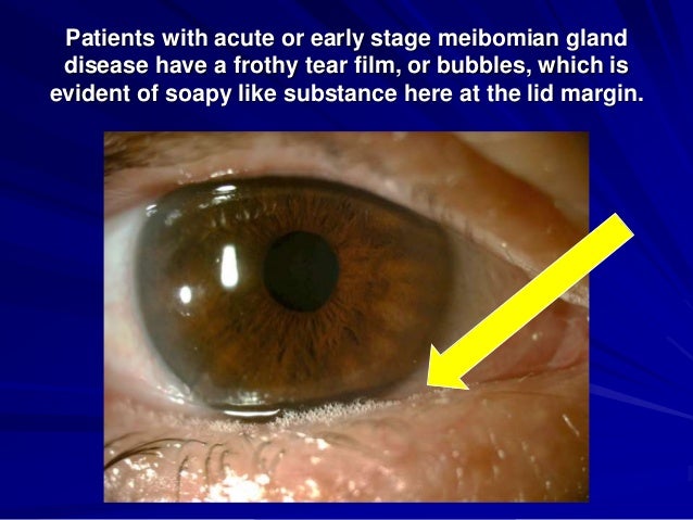 Avenova presentation Nov 2015