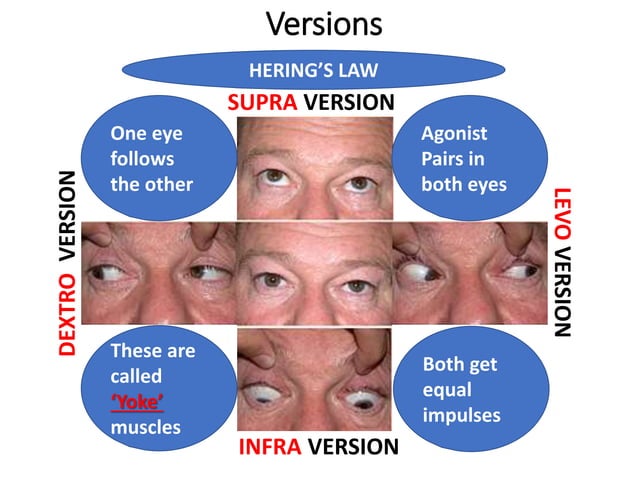 Eye Movements.pptx | Eye and Vision Conditions | Diseases and Conditions