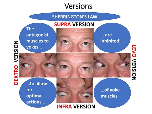 Eye Movements.pptx | Eye and Vision Conditions | Diseases and Conditions