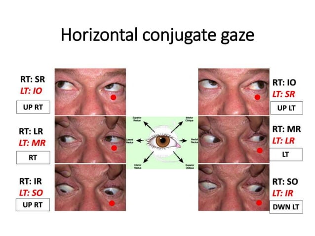 Eye Movements.pptx | Eye and Vision Conditions | Diseases and Conditions