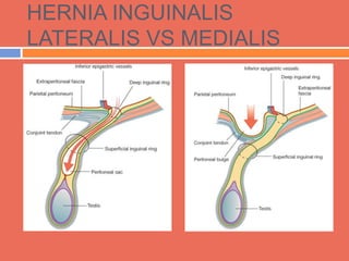 (05) HIL and Hydrocele management in children.ppt | Infertility ...