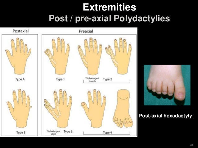 mengenali kelainan fisik tubuh manusia