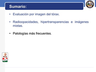 05 Imagenología del Aparato respiratorio-1593612771.pdf