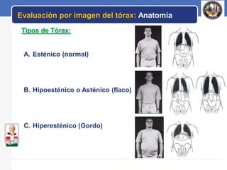 05 Imagenología del Aparato respiratorio-1593612771.pdf