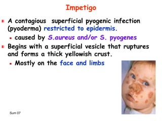 05 Infectious disease Gram Positive | PPT