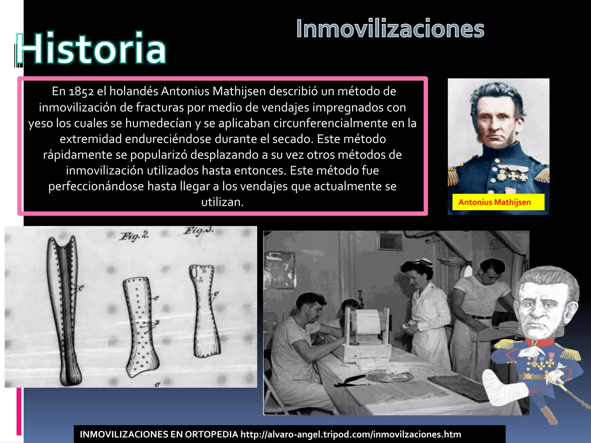 INMOVILIZACIONES LUEGO DE TRAUMATISMOS, LESIONES, ESGUINCES, TORCEDURAS ...