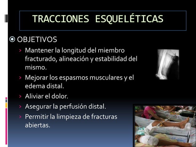INMOVILIZACIONES LUEGO DE TRAUMATISMOS, LESIONES, ESGUINCES, TORCEDURAS ...
