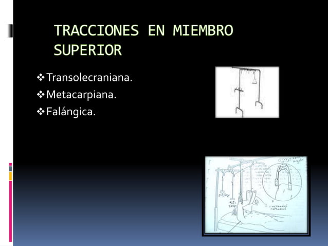 INMOVILIZACIONES LUEGO DE TRAUMATISMOS, LESIONES, ESGUINCES, TORCEDURAS ...