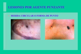 05 Lesiones | PPT