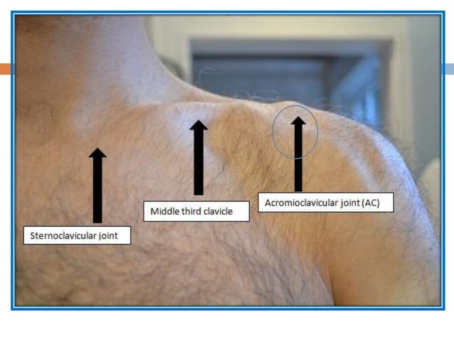 PALPATION_SHOULDER_2019.pptx | Death, Injury, or Military Conflict ...