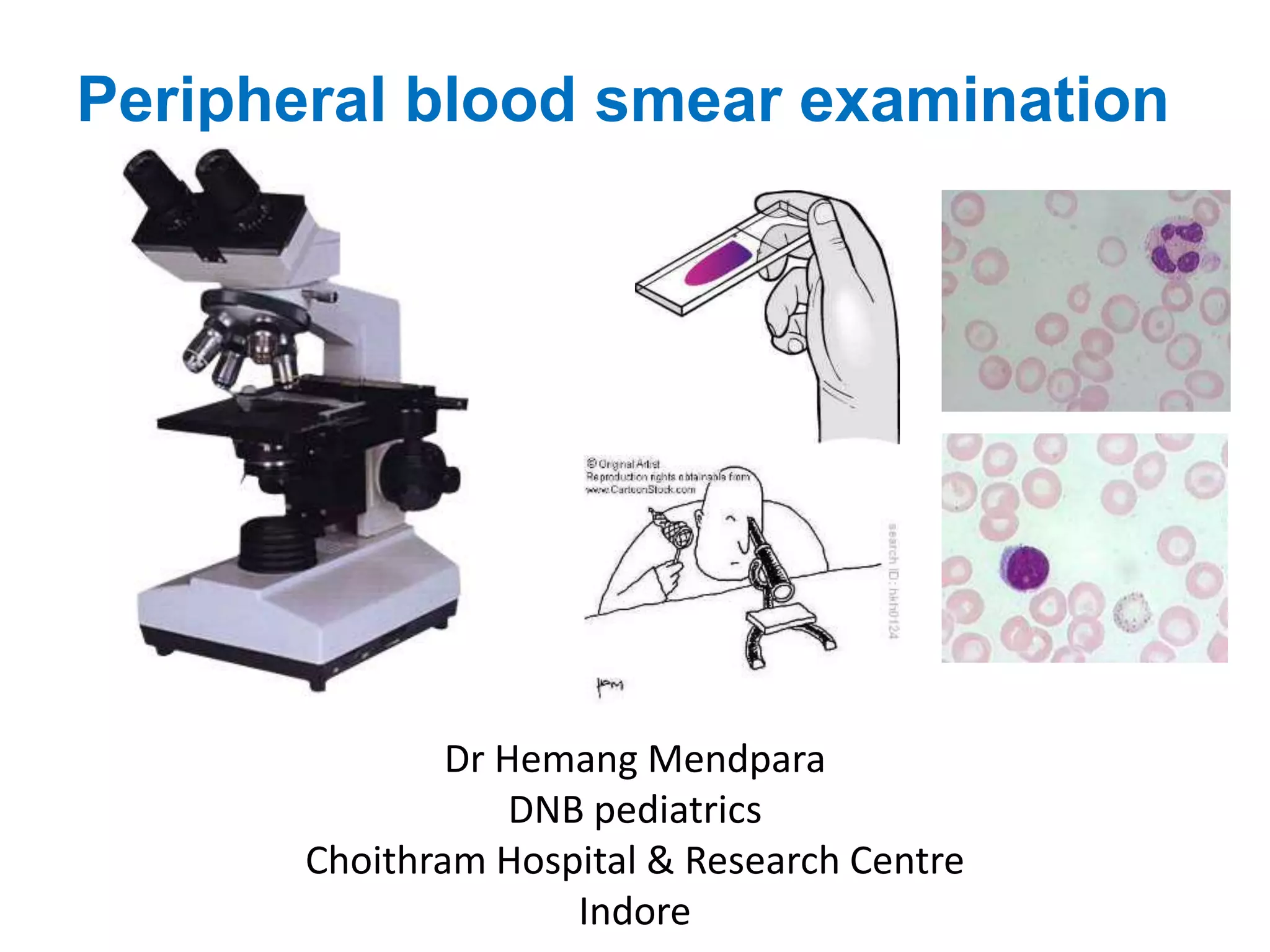 05 peripheral blood smear examination | PPTX