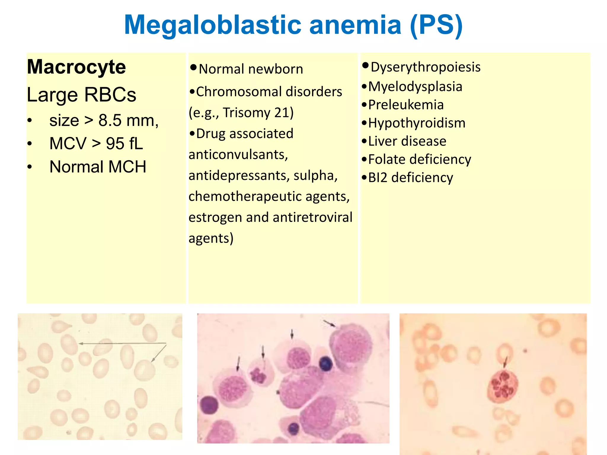 05 peripheral blood smear examination | PPTX