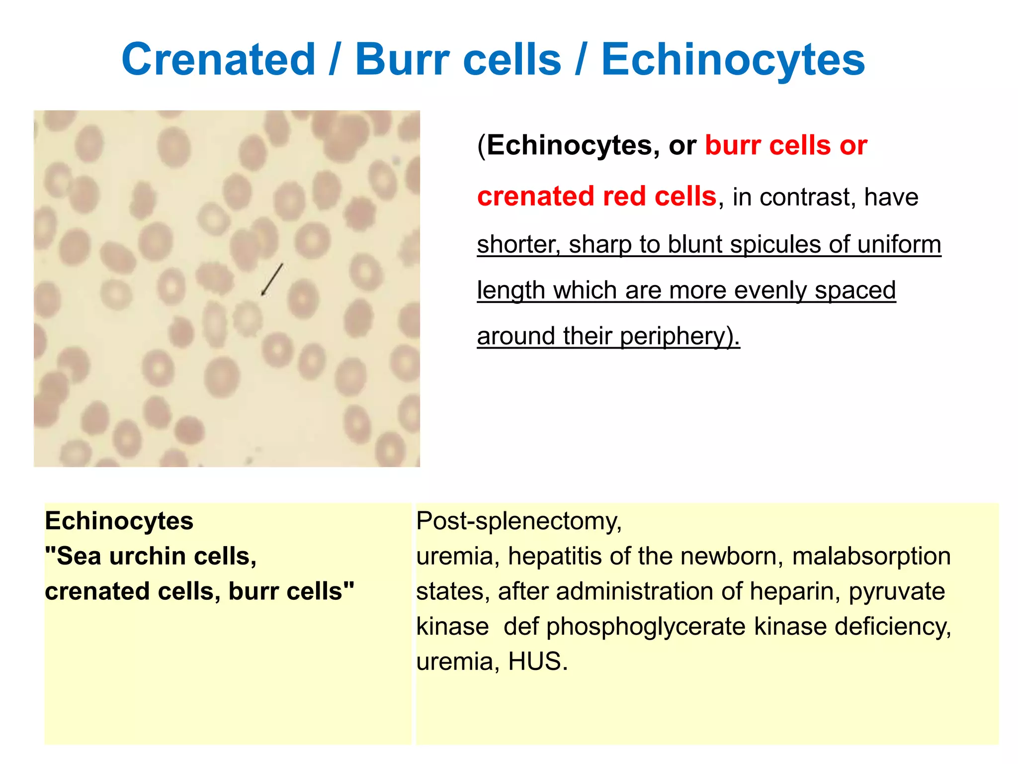 05 peripheral blood smear examination | PPTX