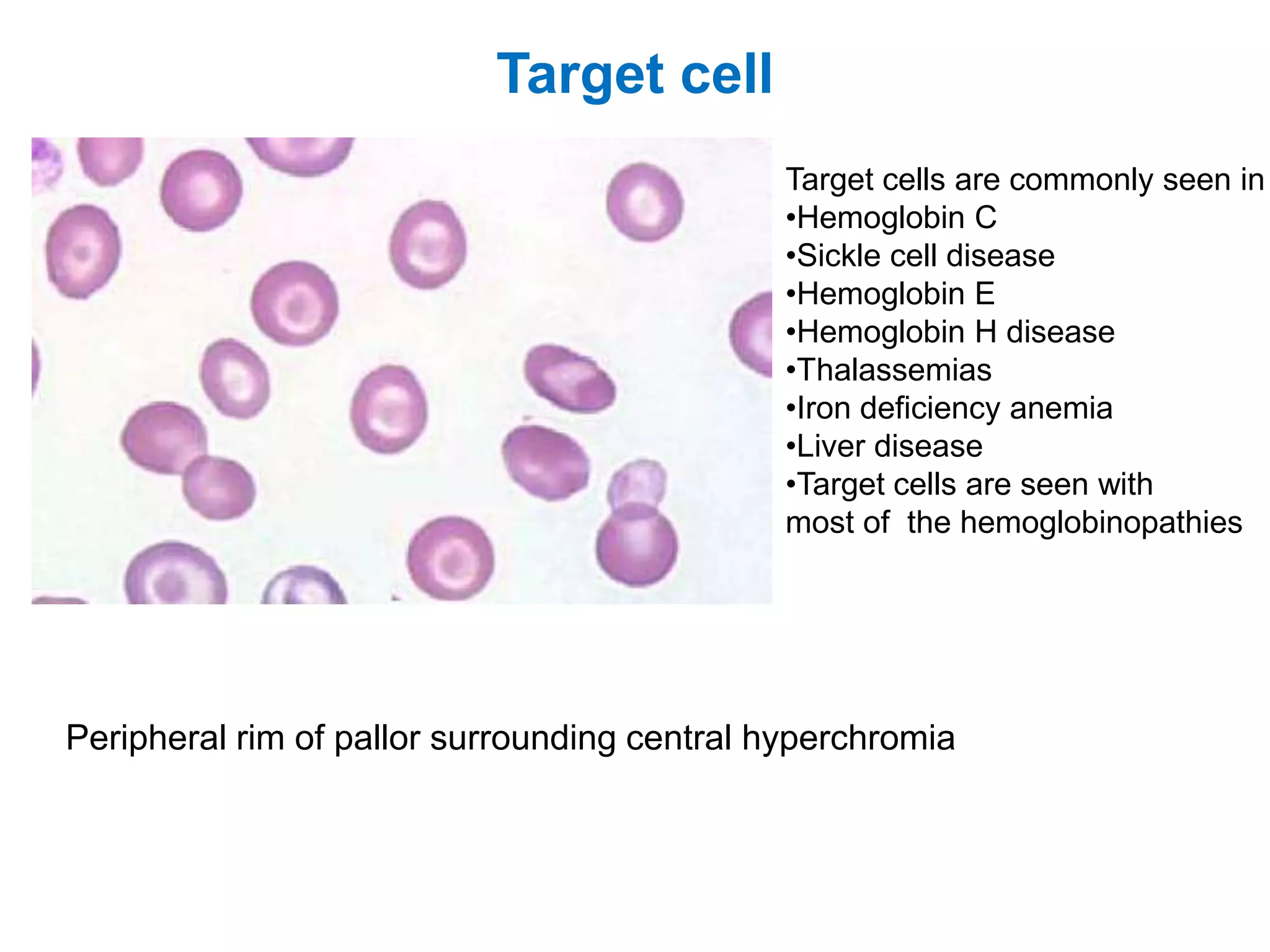 05 peripheral blood smear examination | PPTX