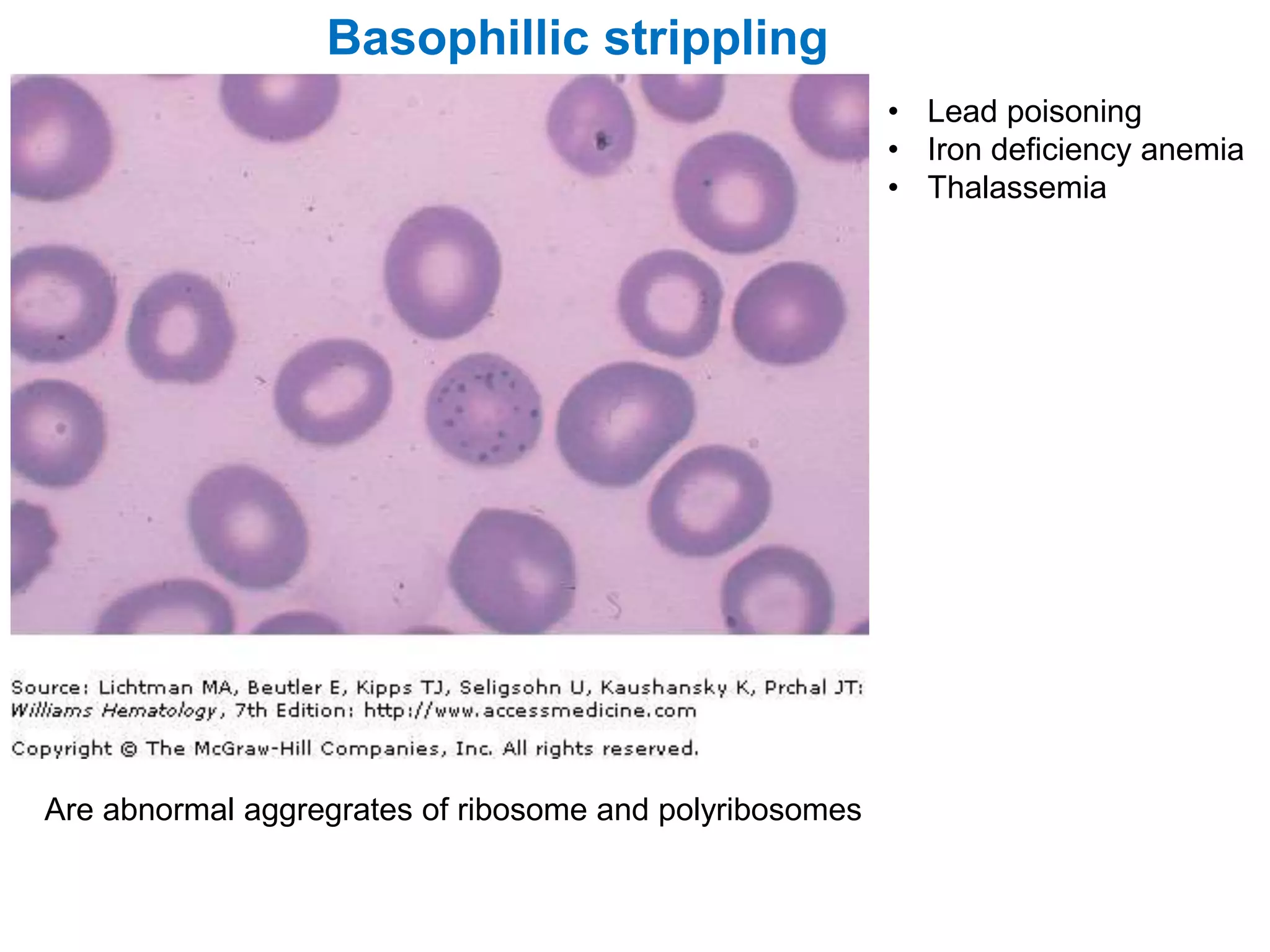 05 peripheral blood smear examination | PPTX