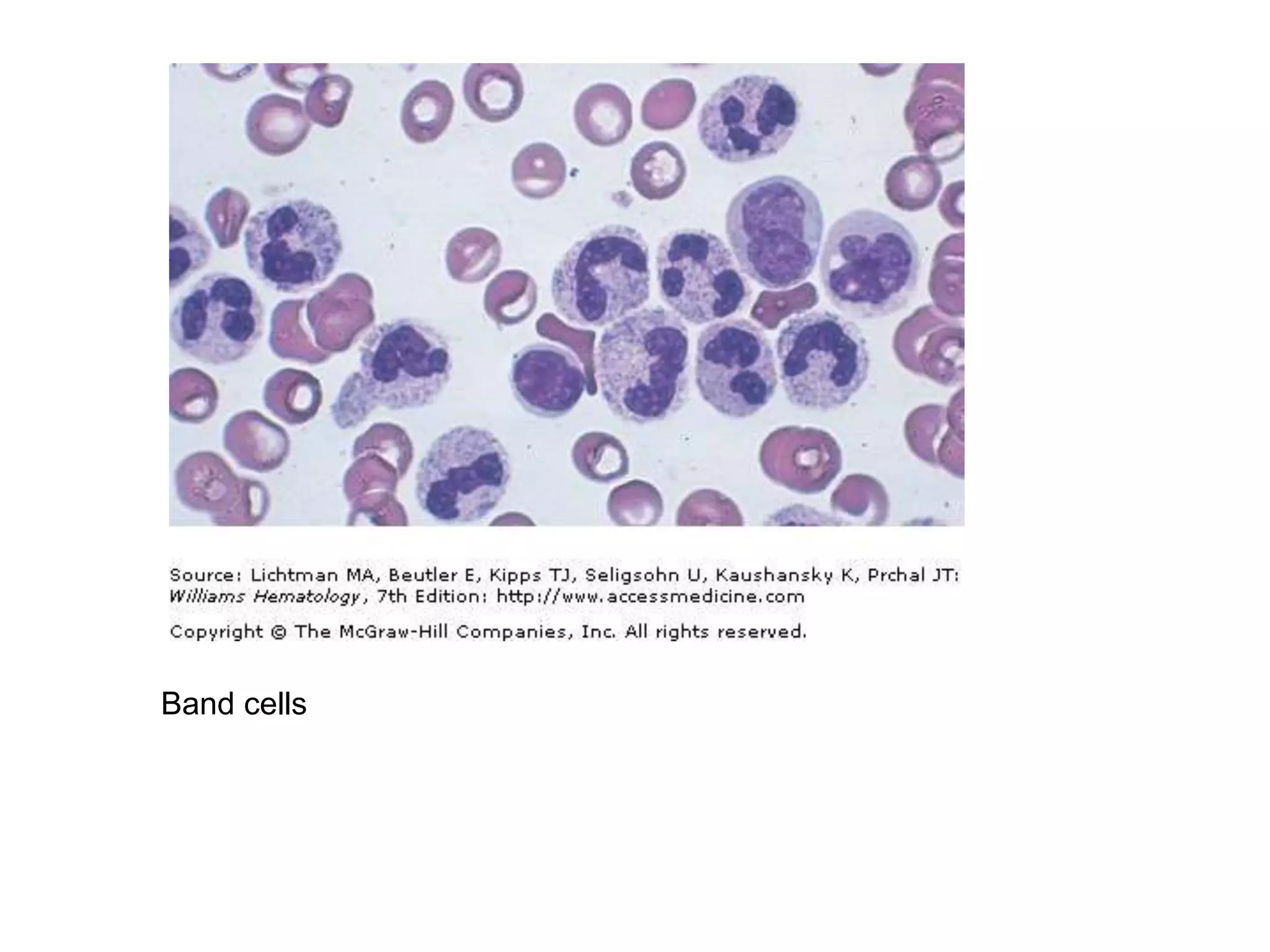 05 peripheral blood smear examination | PPTX