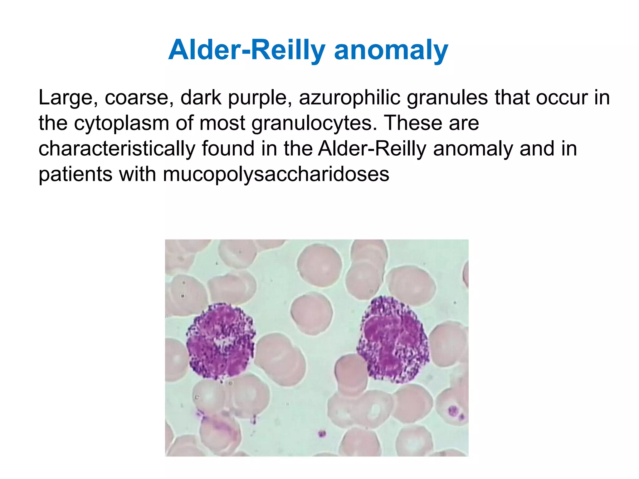 05 peripheral blood smear examination | PPTX
