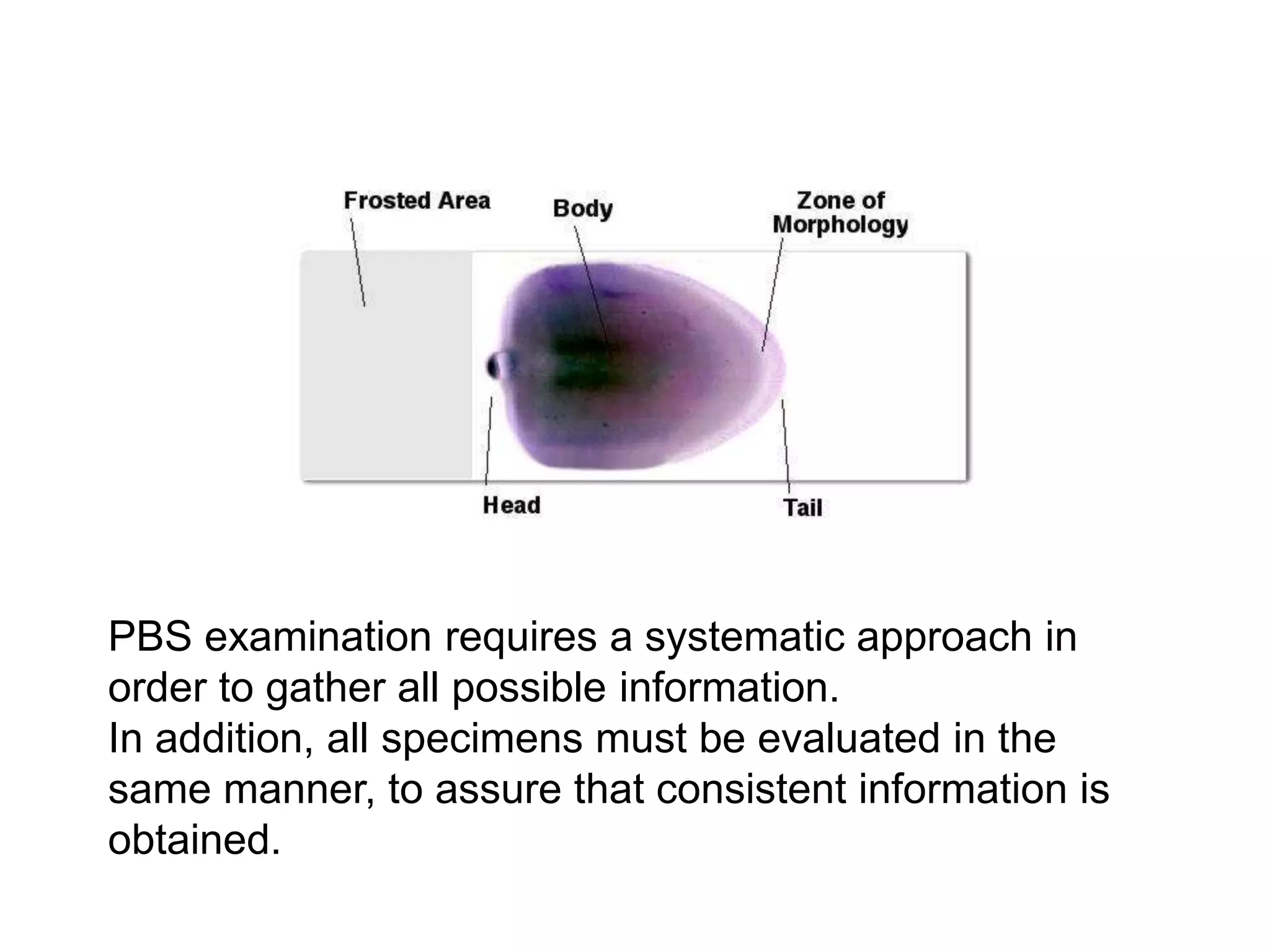 05 peripheral blood smear examination | PPTX