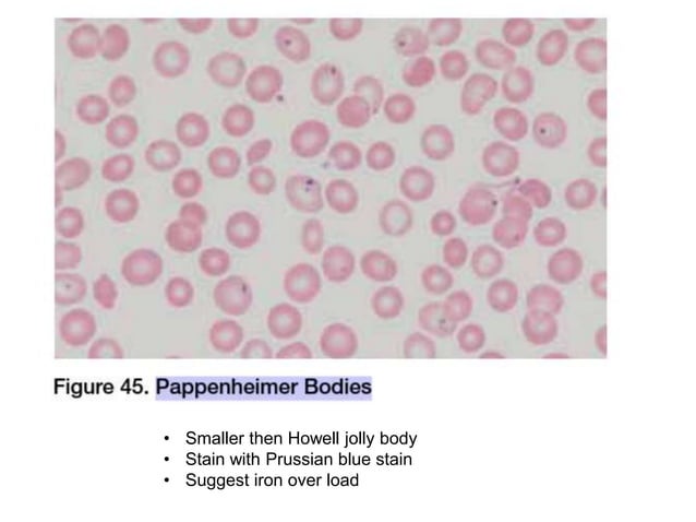 05 peripheral blood smear examination | PPTX